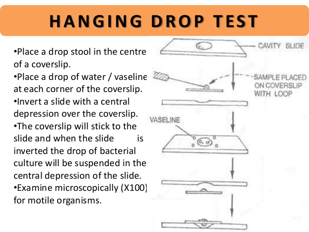 Hanging Drop Technique 식품영양 위키 Fandom Powered By Wikia