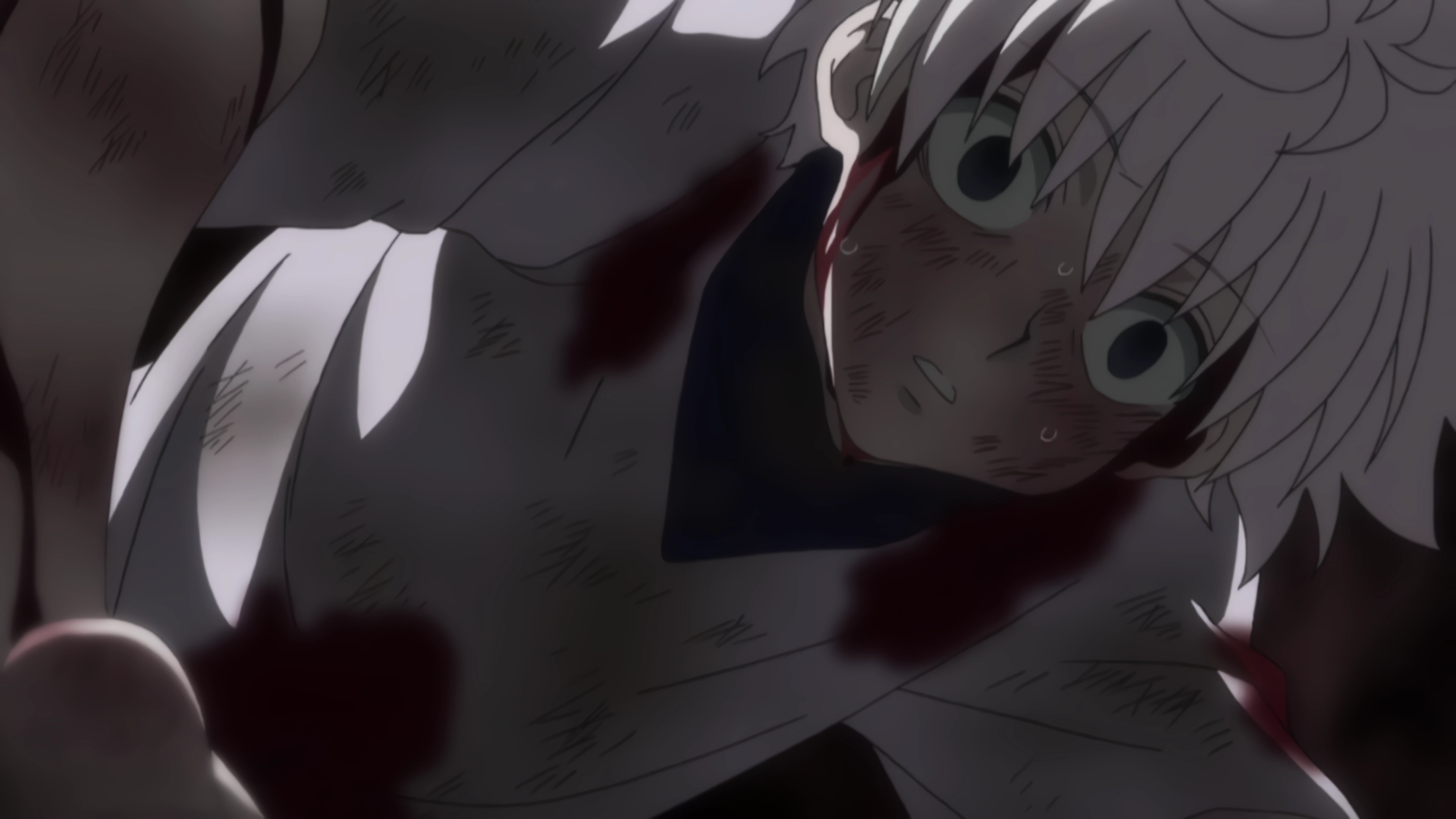 Image - 101 - Killua blood loss.png | Hunterpedia | Fandom powered by Wikia