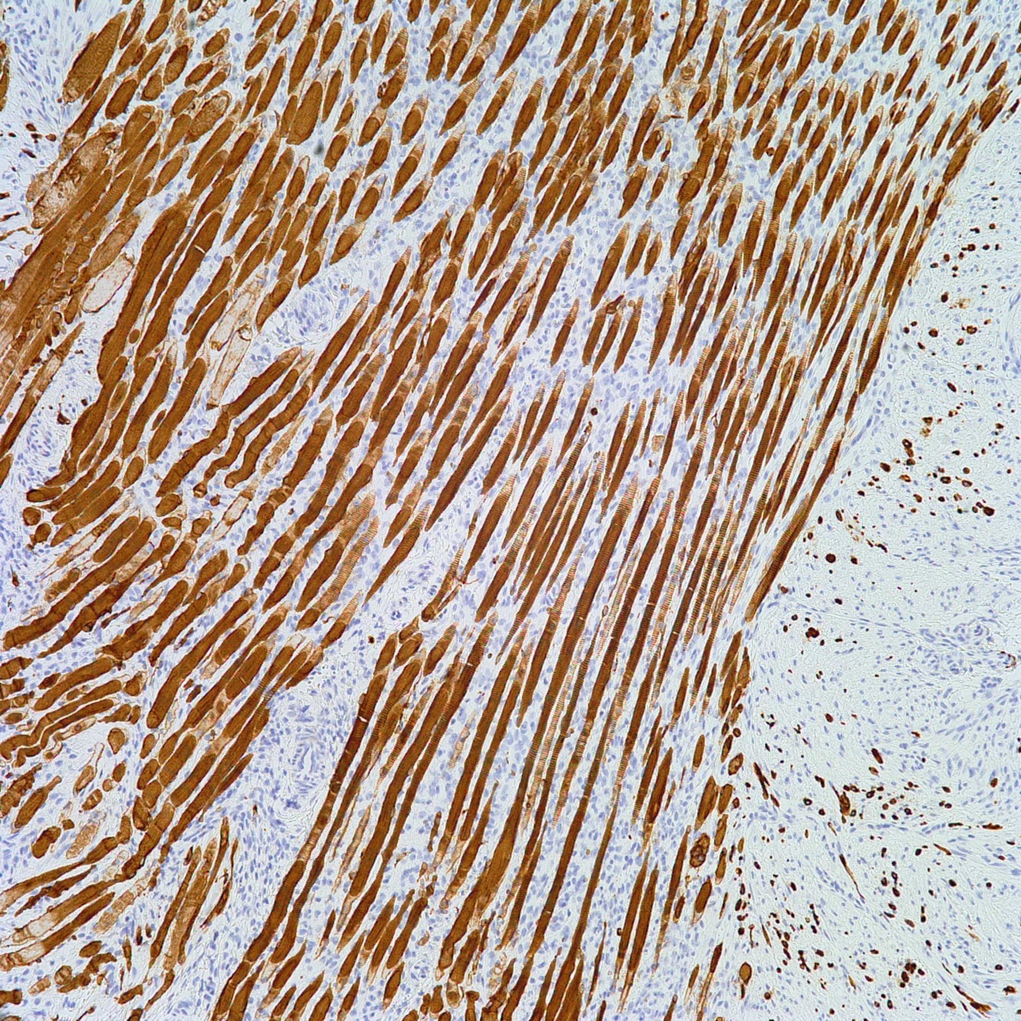 Skeletal Muscle 100x
