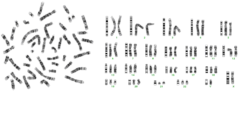 Image - G-banding chromosome chart.gif | UVM Genetics & Genomics Wiki ...