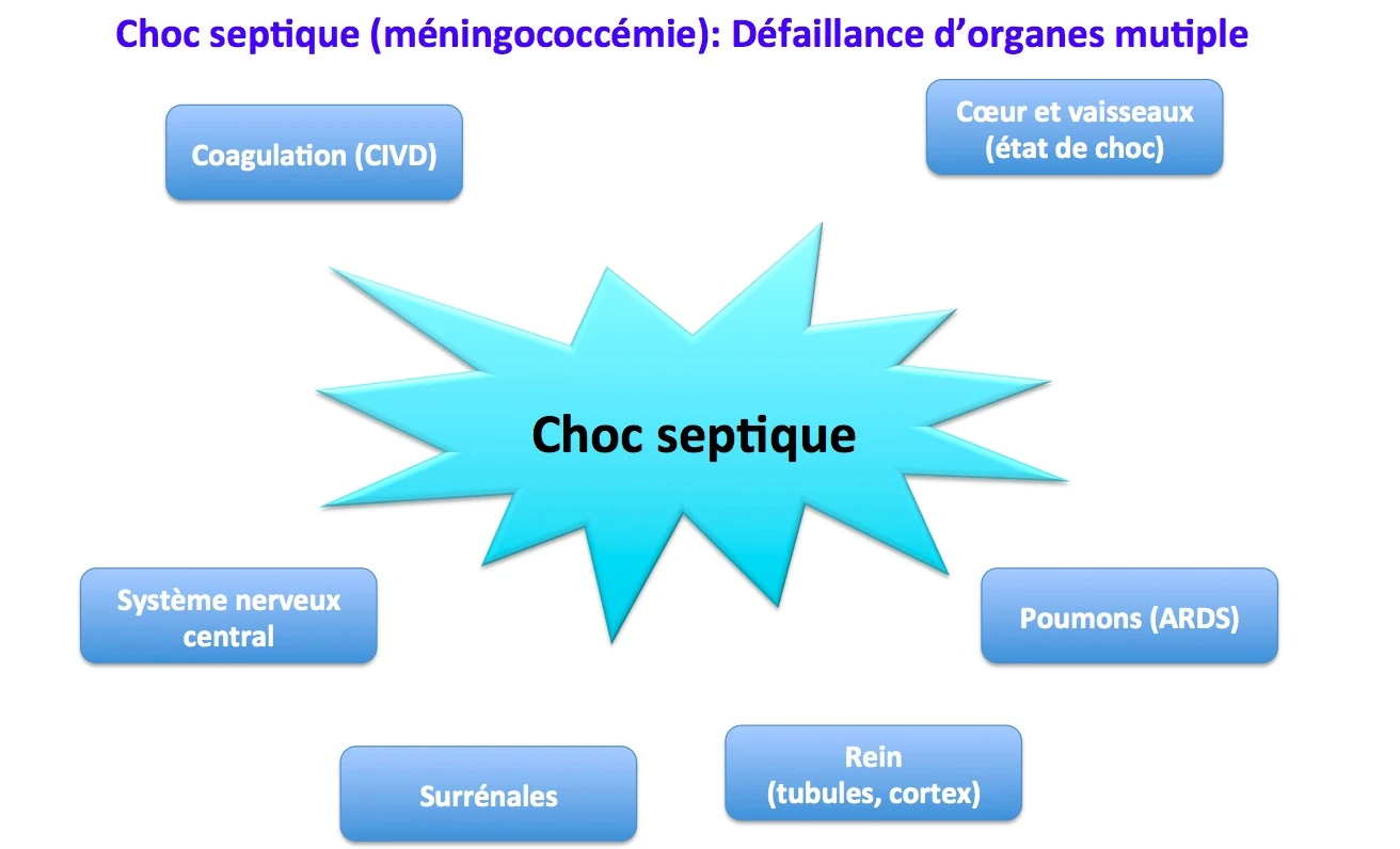 Image - Choc septique.jpg | Wikige Wiki | Fandom powered by Wikia
